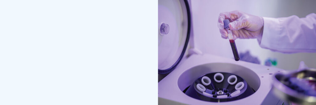 PRP Therapy at Bayes Sports Medicine